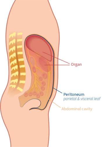 Ascites or water in the abdomen? Inform here | ewimed